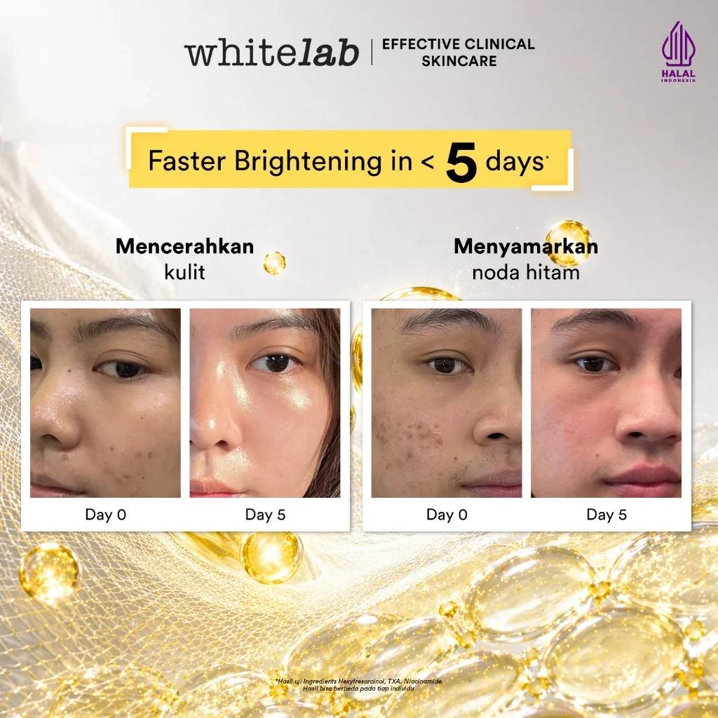 Promo [new Launch] Whitelab Hyperbright Brightening Serum - Serum ...