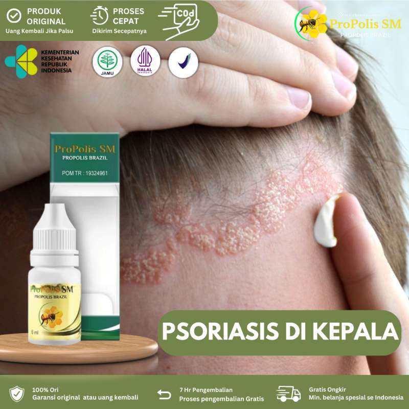 Jual Obat Kulit Kepala Borok 🏷️ 100% Original, Harga & Kualitas Terbaik Mei 2025