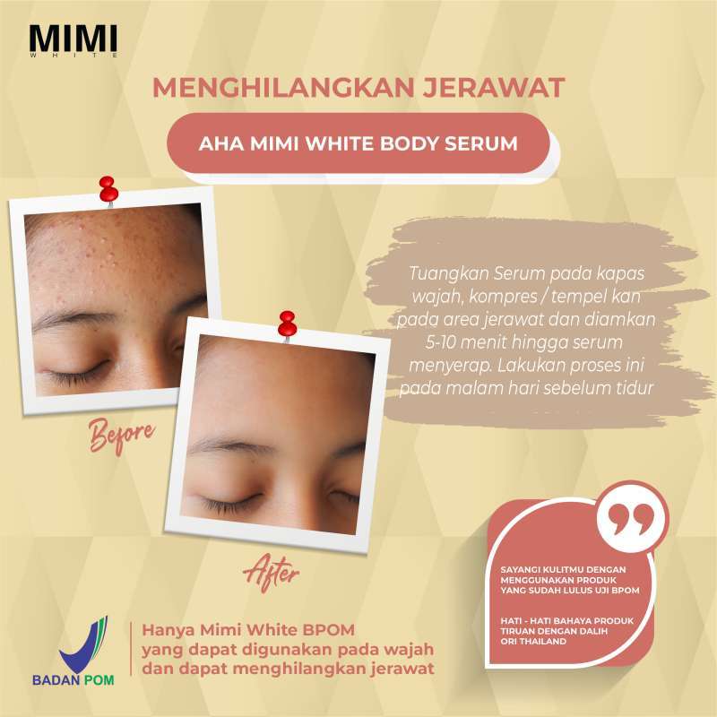 Jual Mimi White Aha Serum 30 Ml + Lotion 100 Ml + Bar Soap 70 Gr Di ...