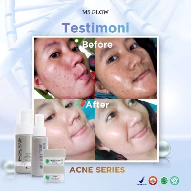 Promo Paket Lengkap Whitening Skincare Wajah Glowing Muka Jadi Glow ...
