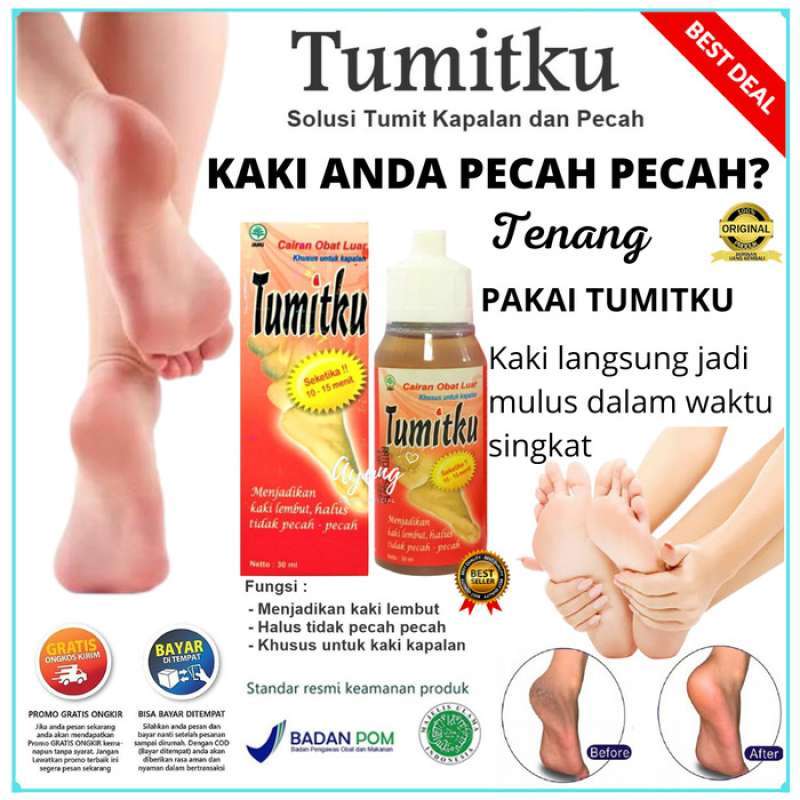 Jual Tumitku Obat Herbal Kaki Pecah Pecah Kapalan Kaki Instan Original ...