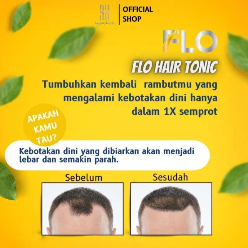 Jual Flo Hair Tonic-penumbuh Rambut Kebotakan-tumbuh Alami Rambut Hitam ...