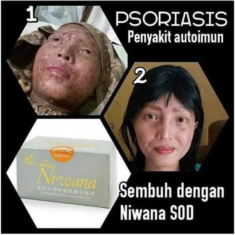 Jual Niwana Sod Suplemen Antioksidan Tinggi Herbal Alami (30 Sachets ...