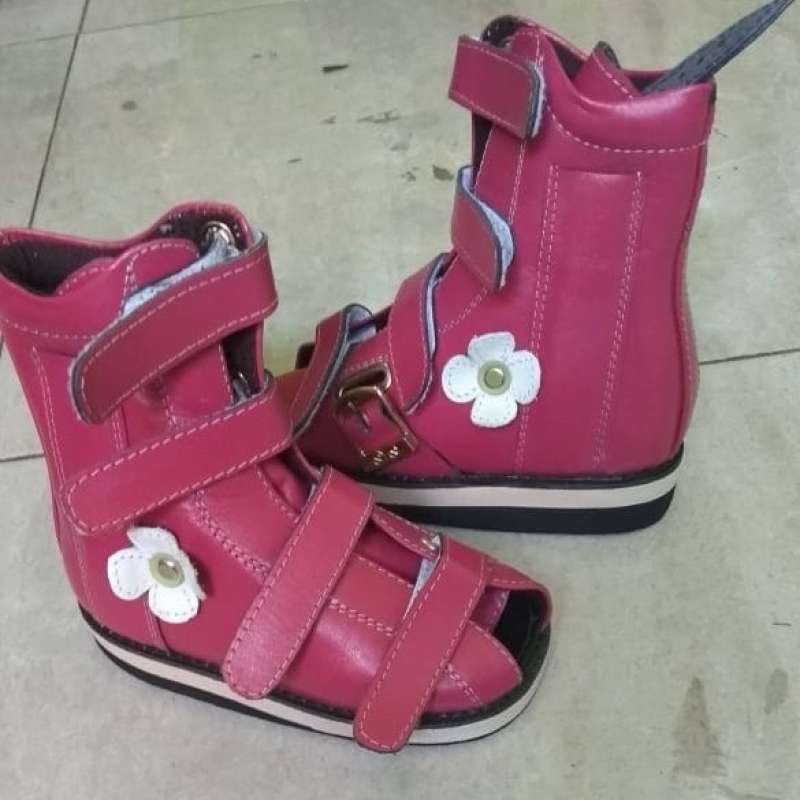 Jual Sepatu Orthopedi Koreksi Kaki Bengkok Clubfoot Ctev - 25 Di Seller ...