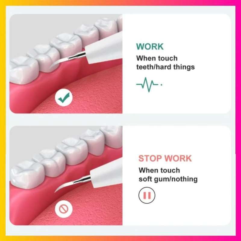 Jual Pembersih Karang Gigi Camera Visual Dental Ultrasonic Scaler Di ...