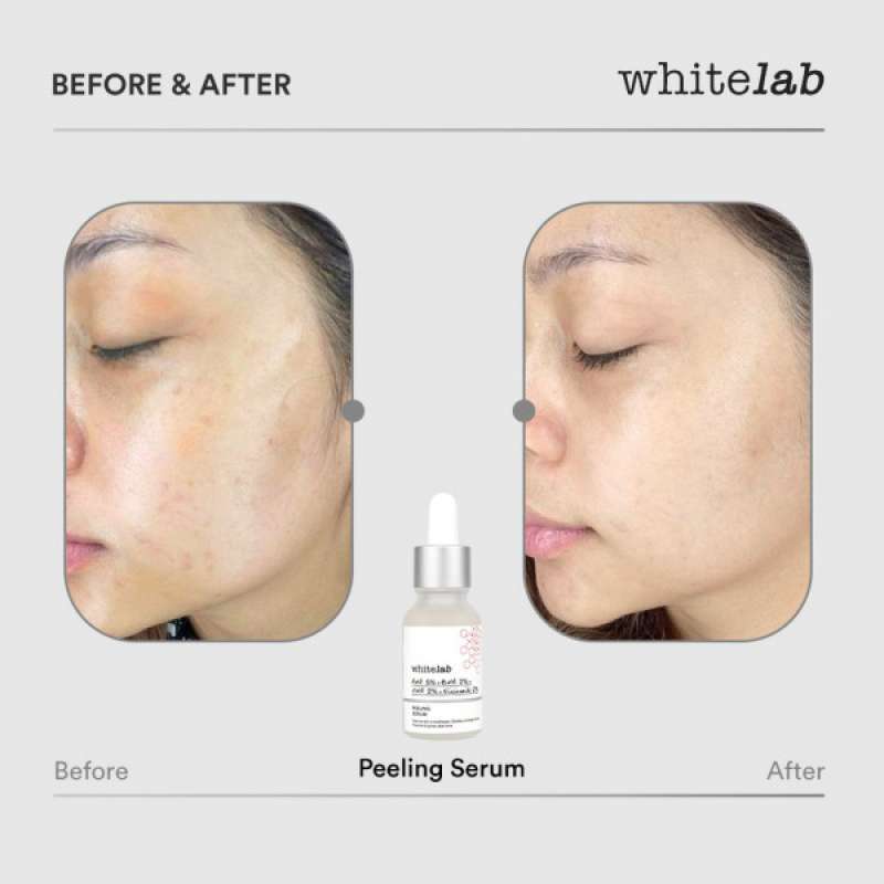 Jual Whitelab- White Lab Peeling Serum 15ml Di Seller Beautee ...