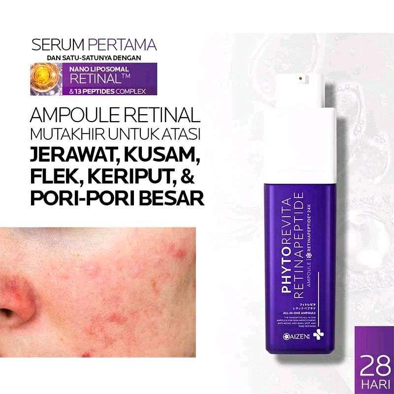 Aizen Phytorevita Retinapeptide Ampoule Gratis Ongkir 🔥 Harga Murah ...