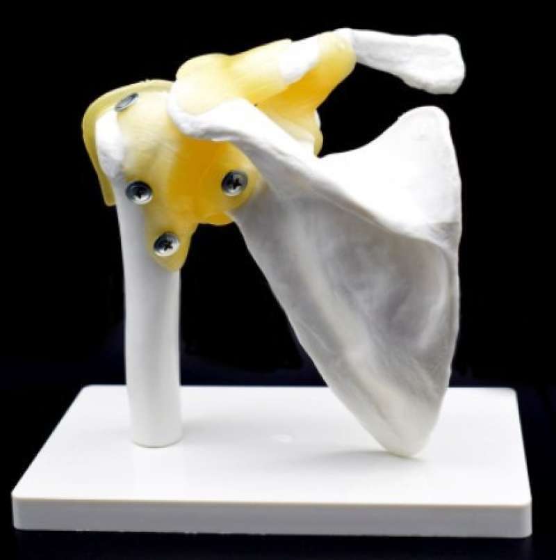 Promo New Life Size Anatomical Functional Human Shoulder Joint Teaching ...