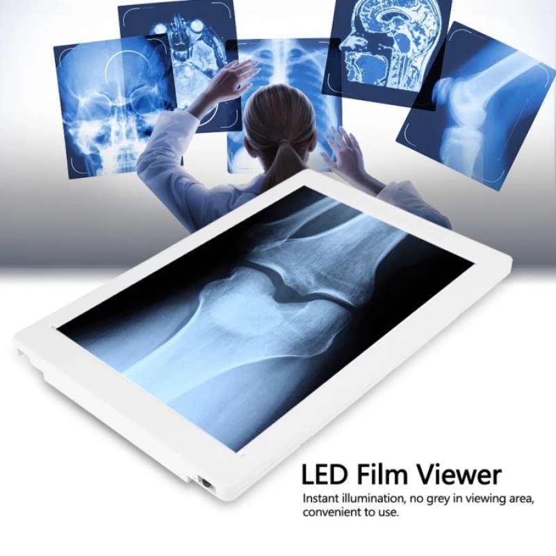 Alat Rontgen Lengkap Harga Terbaru Juni 2024 | Blibli