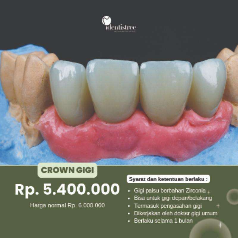 Jual Crown Gigi Zirconia - Harga Termurah Dan Terbaru Di 2024 | Blibli