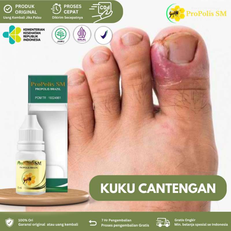 Jual Jamur Kuku Jempol Kaki 🏷️ 100% Original, Harga & Kualitas Terbaik ...