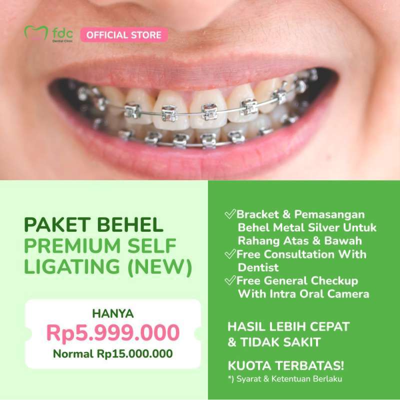 Promo FDC Dental Clinic Kaliurang - Pemasangan Behel Gigi Metal/Ortho ...