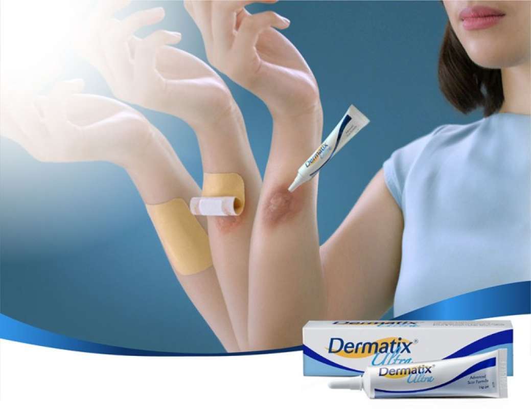 Promo Dermatix Ultra Scar 15gr / Cream Penghilang Bekas Luka / Obat ...