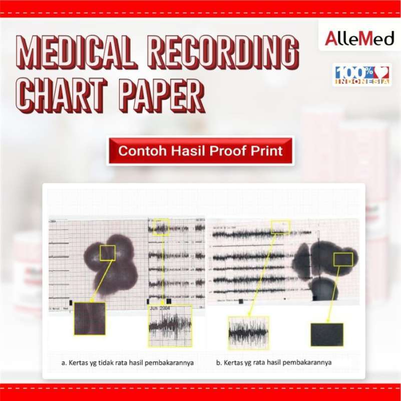 Promo Kertas Ekg 215mm X 25m Ecg Paper Bionet Cardiocare/cardiotouch ...