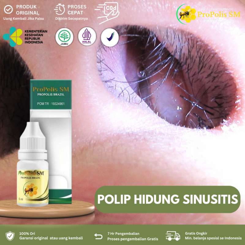Jual Obat Benjolan Di Dalam Hidung, Obat Konka Hidung, Obat Polip ... Jual Obat Benjolan Di Dalam Hidung, Obat Konka Hidung, Obat Polip ...