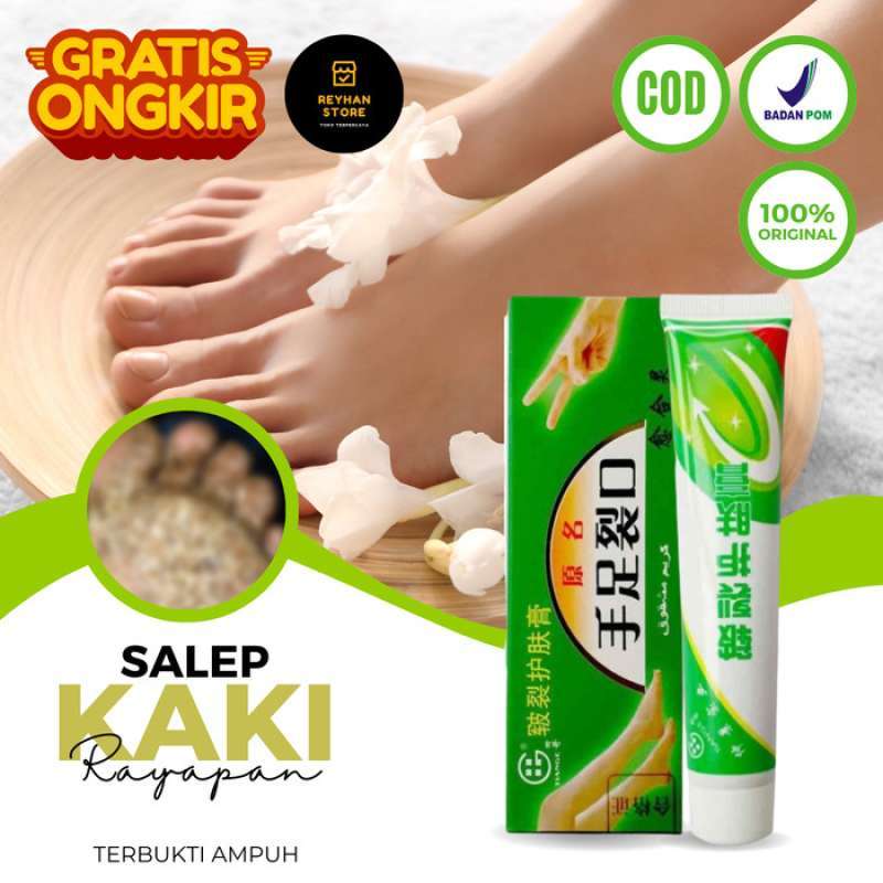 Jual Obat Kaki Rayapan Telapak Kaki Bolong Salep Kaki Pecah Pecah ...