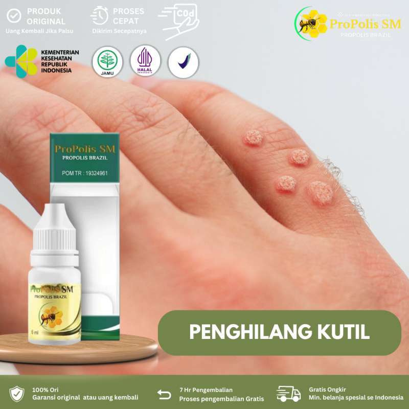 Jual Obat Papiloma, Obat Penghilang Papiloma, Obat Kutil, Obat ... Jual Obat Papiloma, Obat Penghilang Papiloma, Obat Kutil, Obat ...