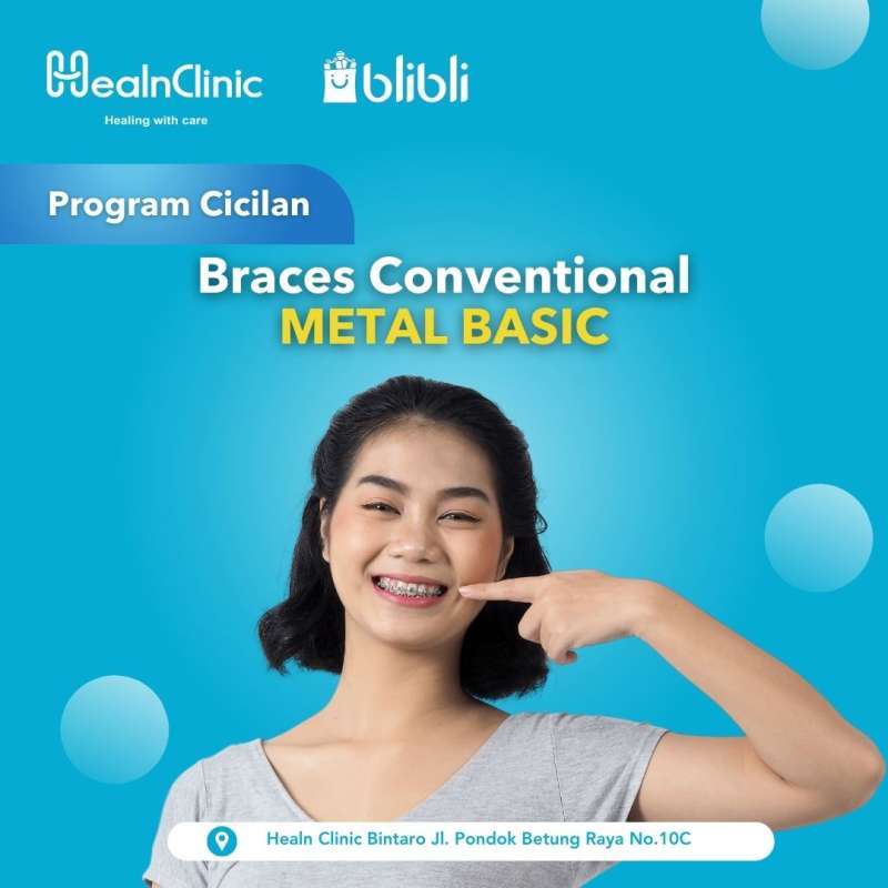Promo Ortho/behel/braces Conventional Metal Basic Healn Diskon 28% Di Seller Healn Clinic ...
