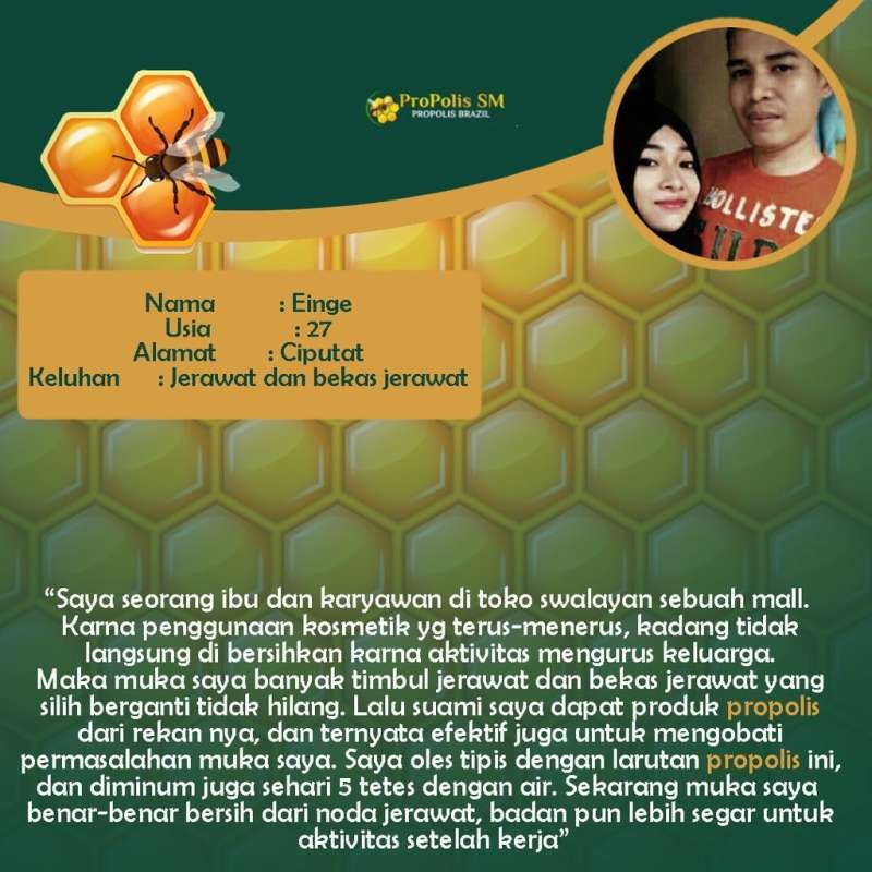 Jual Obat Jerawat Bernanah Cenang Bisul Di Wajah Abses Kulit Jerawat ...
