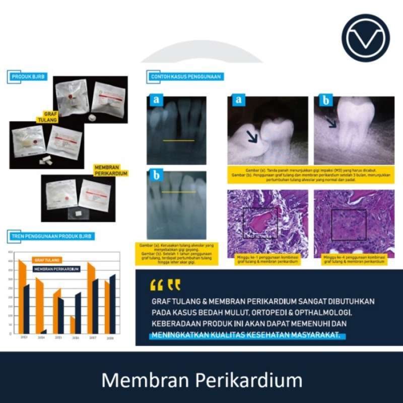 Promo Membran Perikardium / Pericardium Membrane Diskon 23% Di Seller ... Promo Membran Perikardium / Pericardium Membrane Diskon 23% Di Seller ...