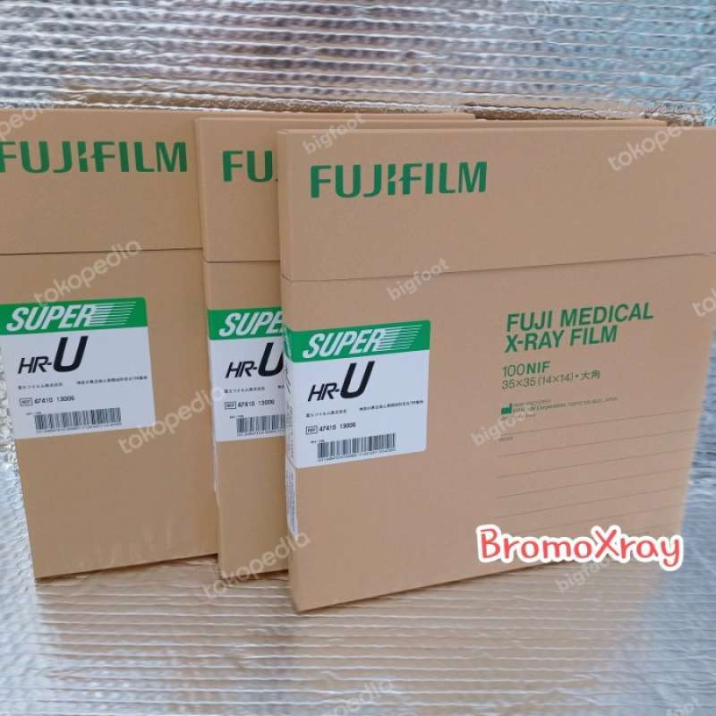 Jual Fuji Xray Film Shr-u Uk. 35x35 Rontgen Ronsen Rongsen Radiologi X ...