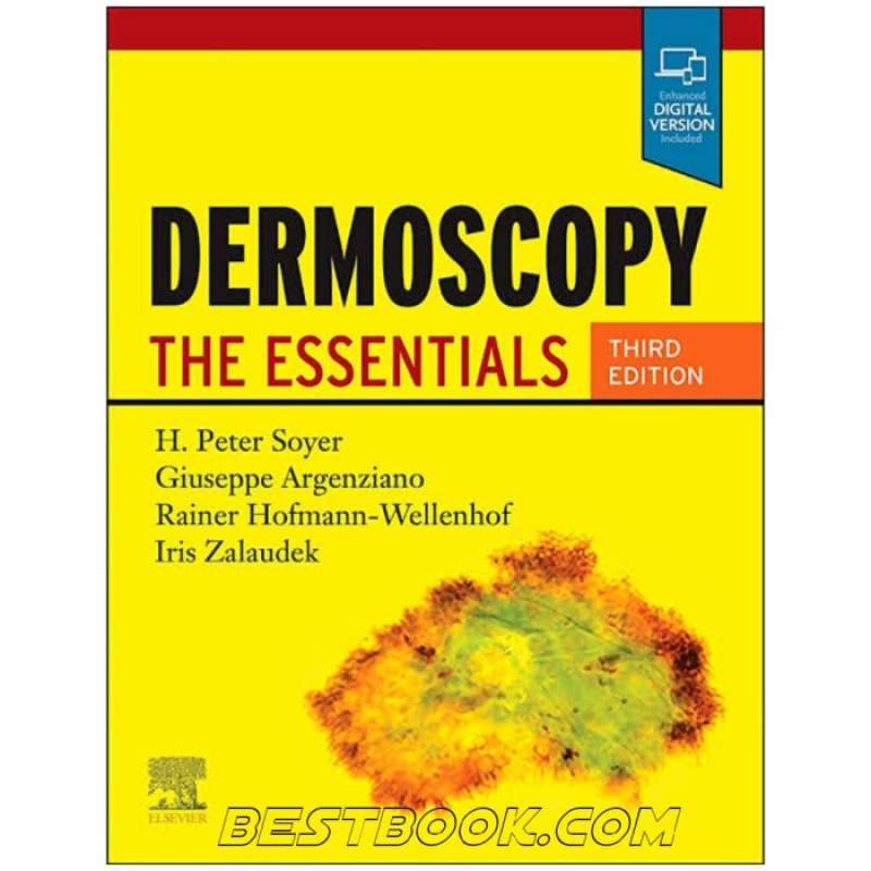 Promo Dermoscopy The Essentials 3e - H Peter Soyer Diskon 23% Di Seller ...