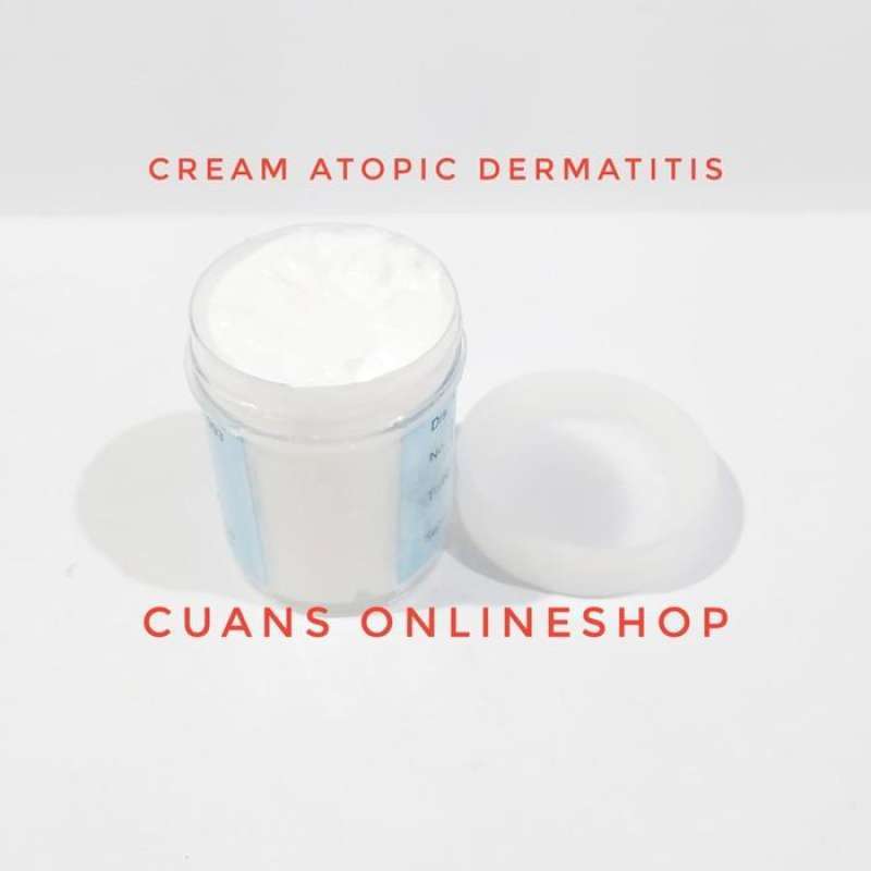 Jual Salep Eczema Atau Cream Atopic Dermatitis Salep Eksim Dan Alergi ...