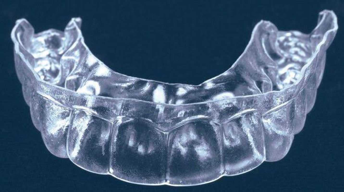 Promo Dental Retainer Atau Plastik Splint Soft 1,5mm Diskon 23% Di ...