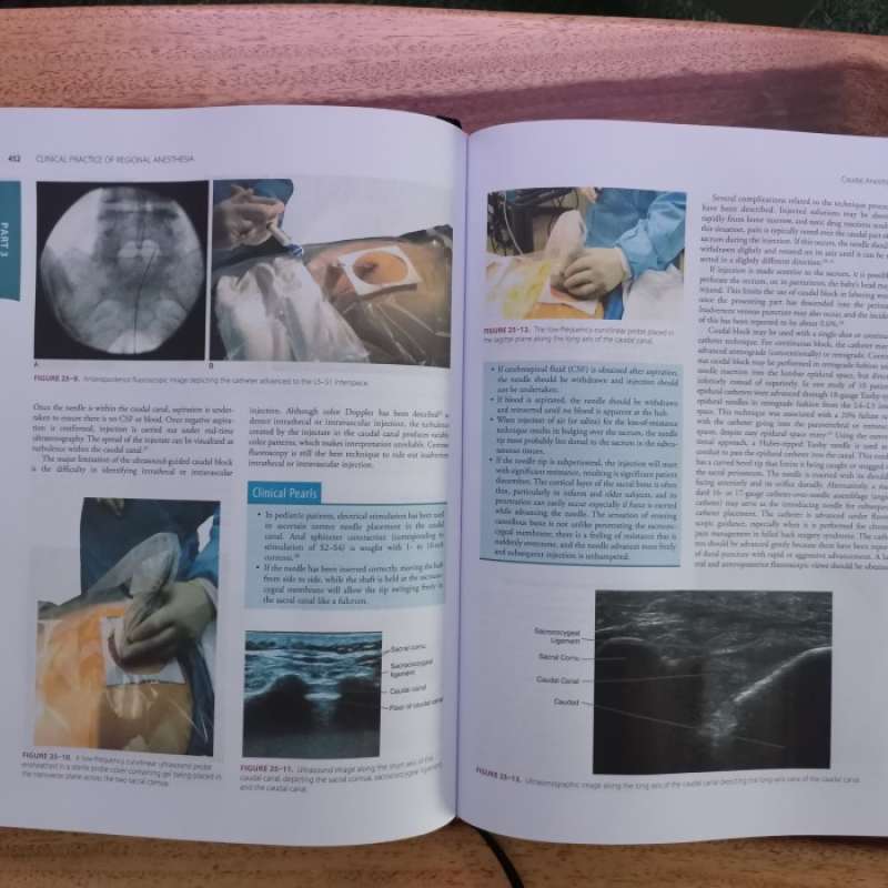 Jual Buku Kedokteran Hadzic Textbook Of Regional Anesthesia 2e Di ...