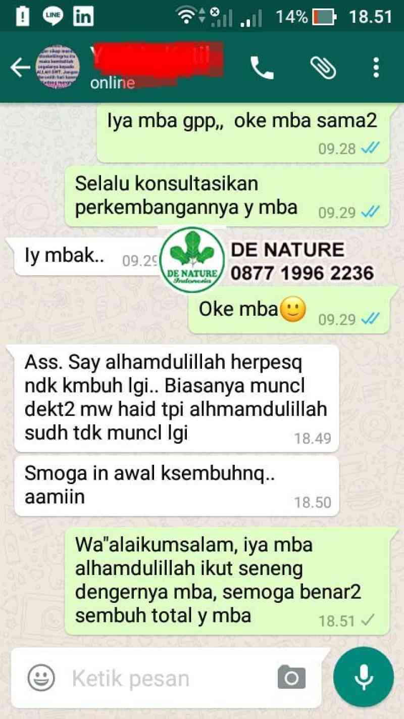 Promo Obat Herpes Herbal, Cacar Ular, Cacar Air, Zoster, Genital Ampuh ...