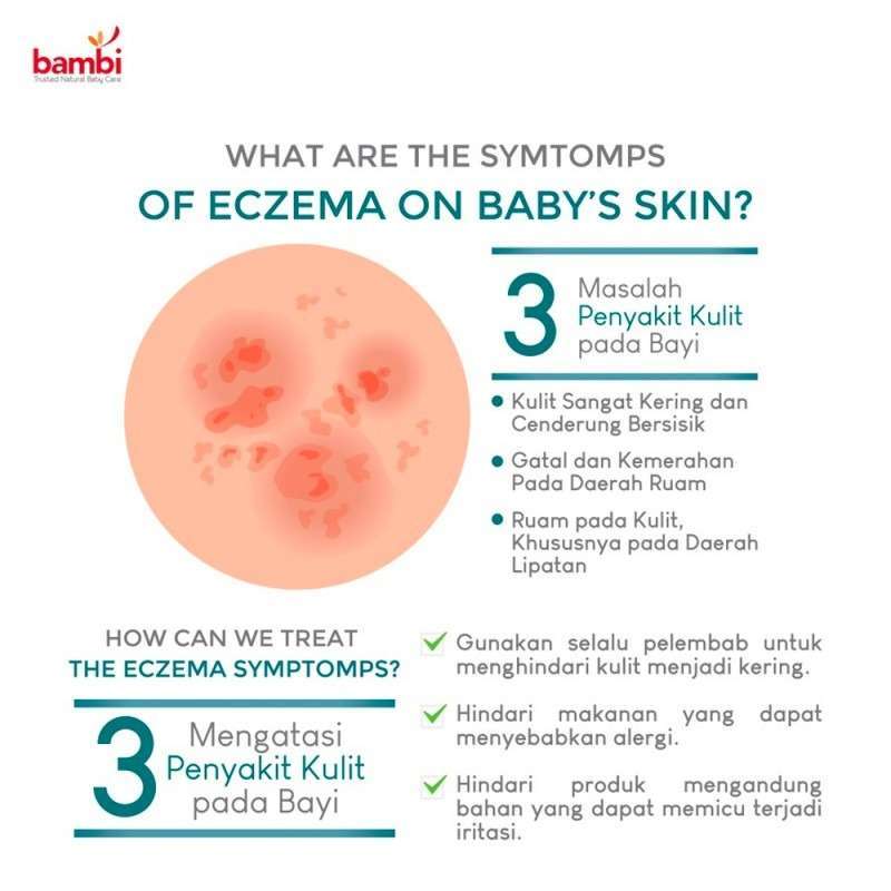 Jual Bambi Baby Dermacare For Sensitive Skin Face Cream/body Lotion ...