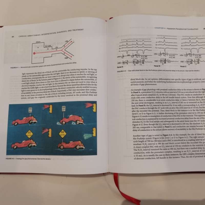 Jual Cardiac Arrhythmias Interpretation Diagnosis And Treatment 2e 2020 Di Seller Noelle