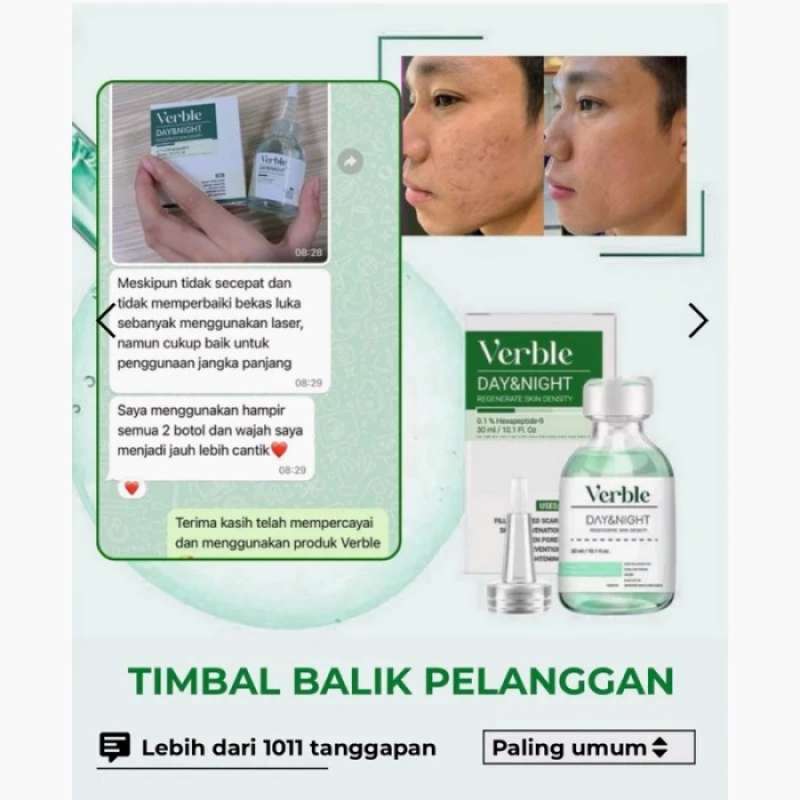 Jual Verble Day/night Serum Bekas Luka Berlubang,bopeng Di Seller ...