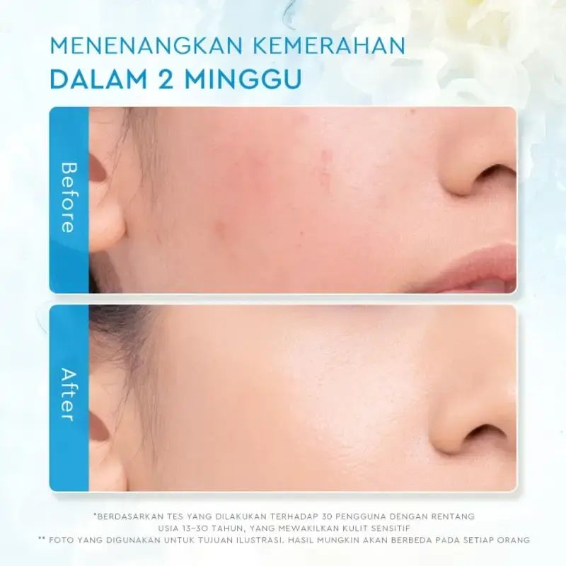 Jual Glad2glow Tremella Vita B5 Sensitive Calming Moisturizer | Gel Day ...