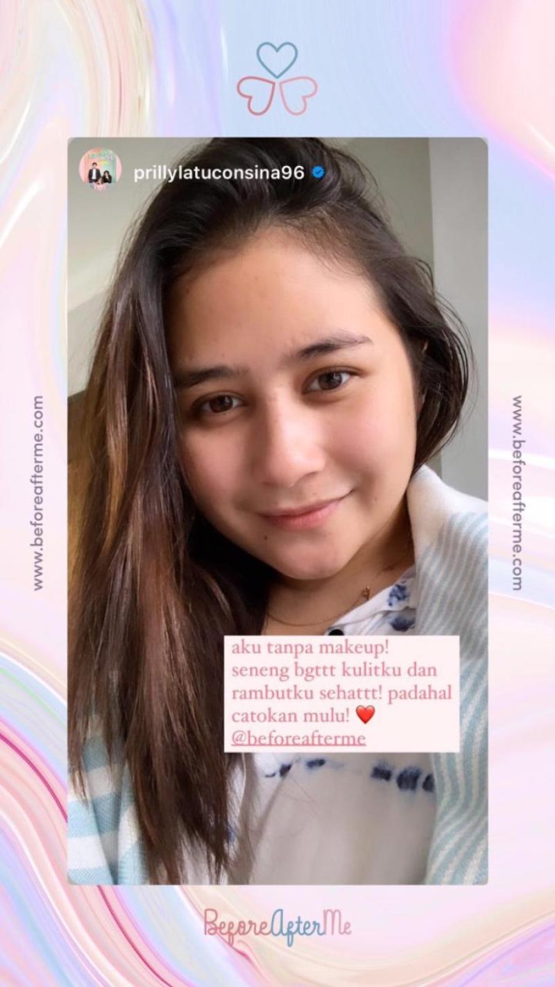 Jual Beforeafterme / Before After Me Minuman Collagen Prilly ...