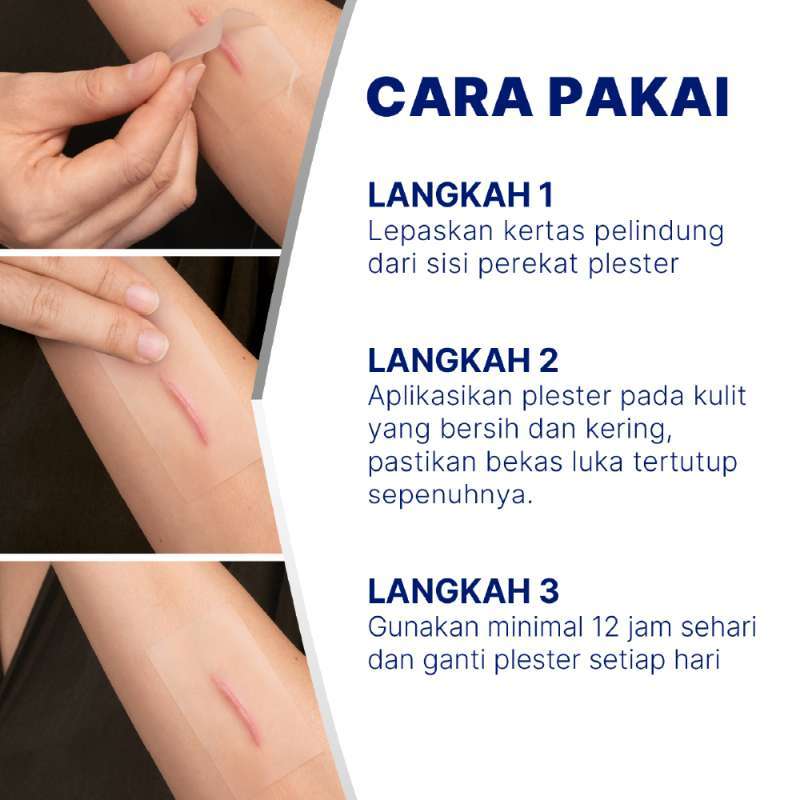 Jual Hansaplast Plester Bekas Luka [21 Lembar] - Menghilangkan Bekas ...