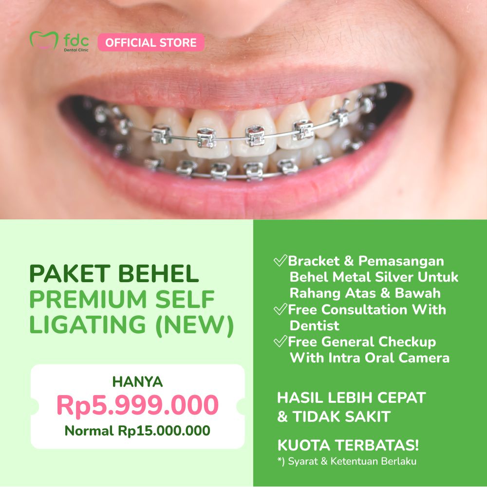 Promo FDC Dental Clinic Bekasi - Pemasangan Behel Gigi/Ortho/Kawat Gigi ...