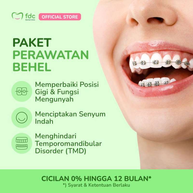 Jual Fdc Dental Clinic Bekasi - Pemasangan Behel Gigi Metal/ortho/kawat ...