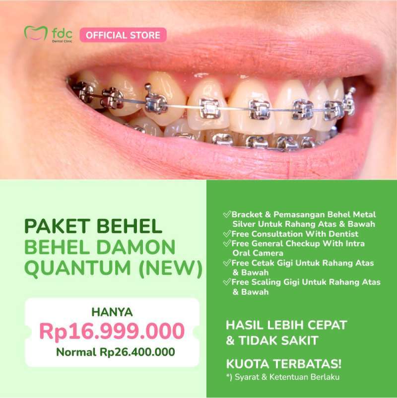Jual Behel Damon Terbaik - Harga Terbaru 2024 | Blibli