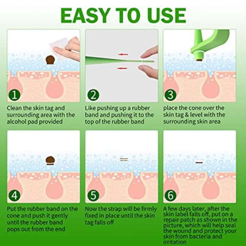 Jual Skin Tag Removal Products Kit, Mushroom Cookies Tag Away Skin Di ...