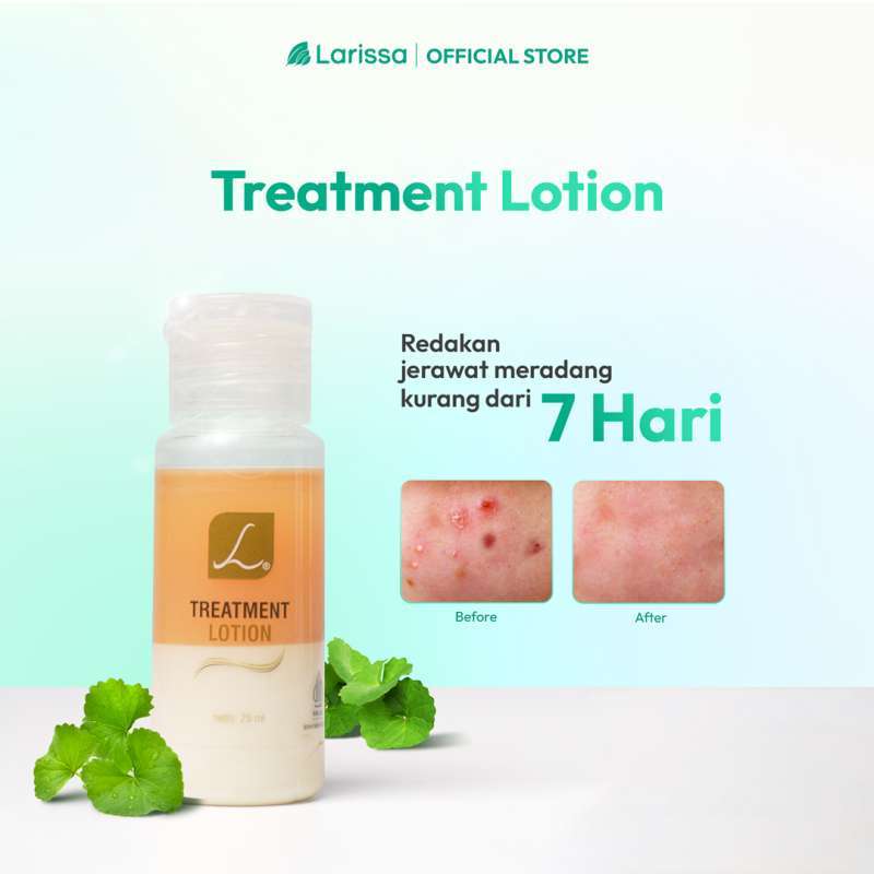 Obat Jerawat Larissa Gratis Ongkir 🏷️ Harga Murah April 2026