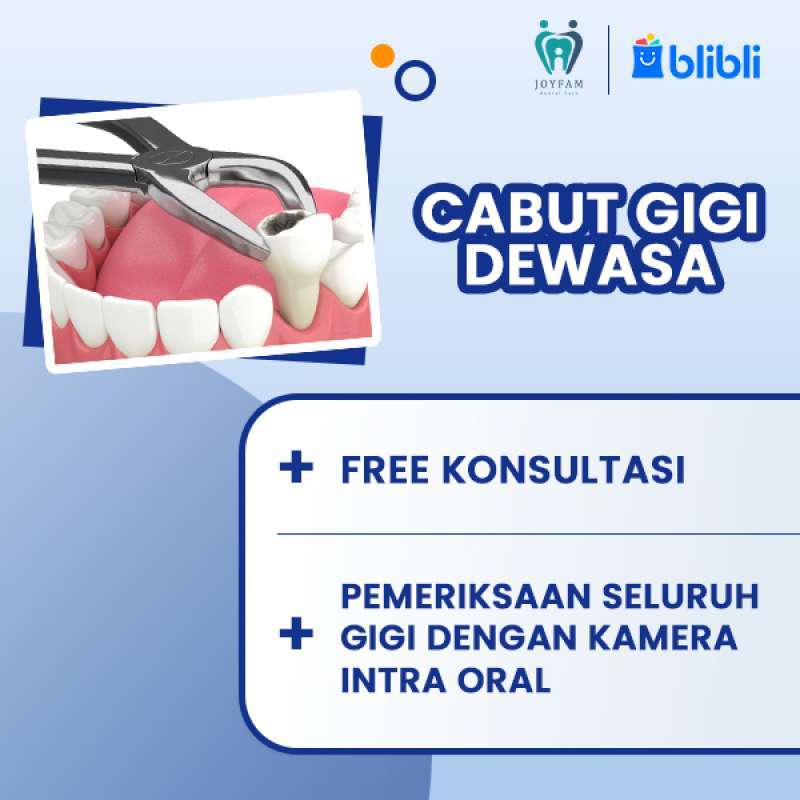 Promo Joyfam - Cabut Gigi Dewasa Diskon 30% Di Seller Joyfam Dental Care - Bojong Rawalumbu ...