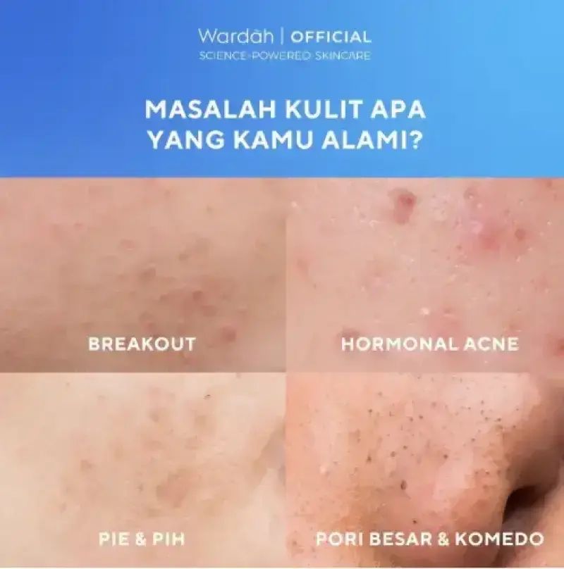 Promo New! Wardah Uv Shield Acne Calming Sunscreen Moisturizer Spf 35 ...