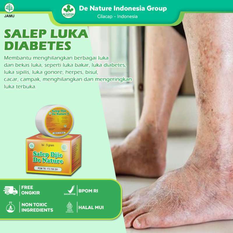 Jual Salep Djie Gel Obat Pengering Luka Diabetes Kering / Basah Obat ...