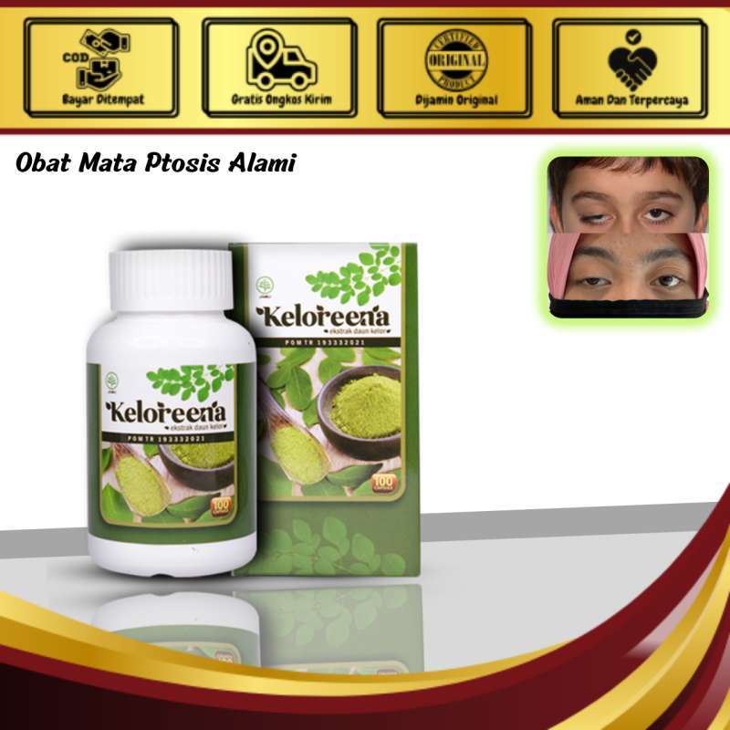 Promo Obat Mata Ptosis, Kelopak Mata Turun, Mata Sipit Beda Sebelah ...
