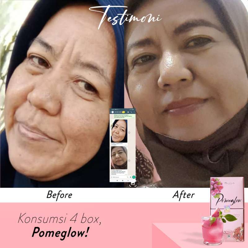 Jual Original Pomeglow Collagen Drink Isi 15 Sachet Di Seller Touta ...