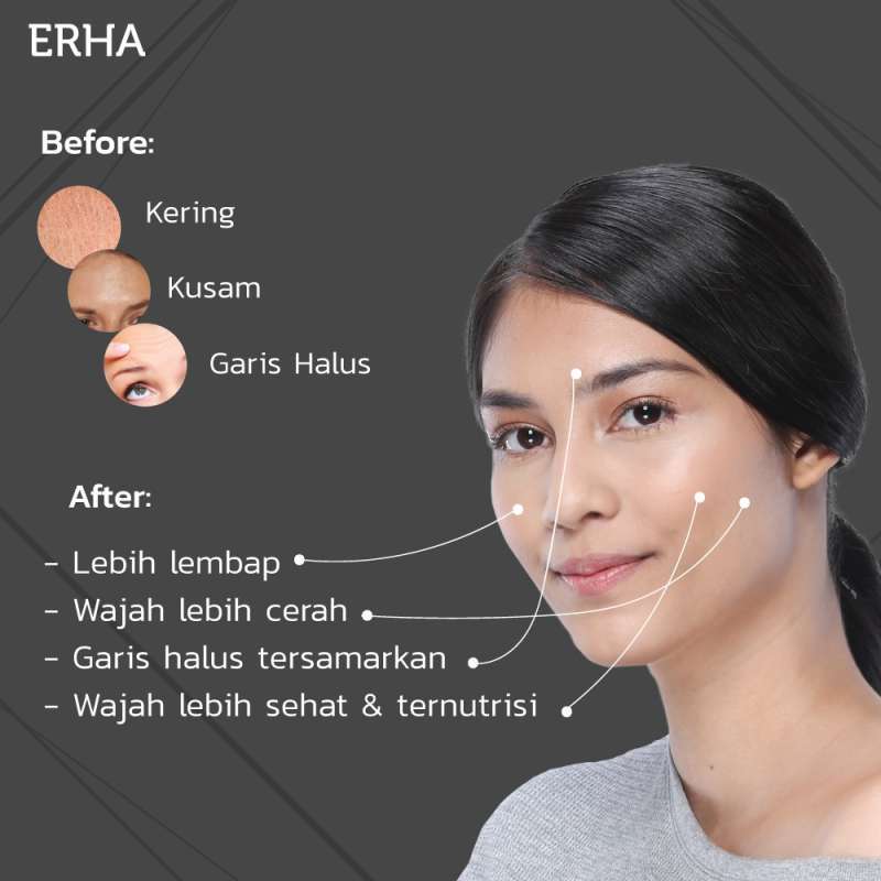 Promo Erha Essential Moisturizer, Krim Pelembab Wajah Anti Aging Dgn ...