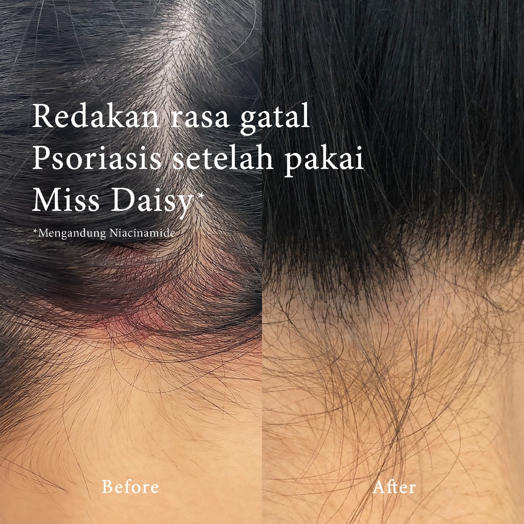 Promo Miss Daisy Shampoo Peony & Amber 500ml Diskon 10% Di Seller Miss ...