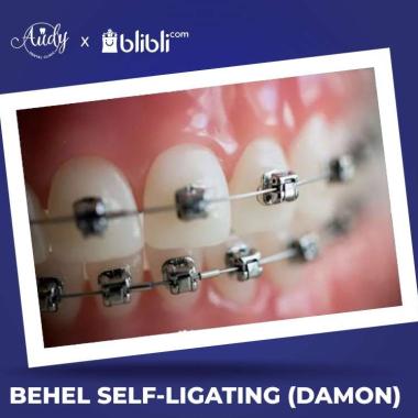 Jual Self Ligating - Harga Termurah Dan Terbaru Di 2022 | Blibli