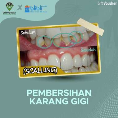 Paket Pemeriksaan Gigi Lengkap Harga Terbaru Desember 2022 | Blibli